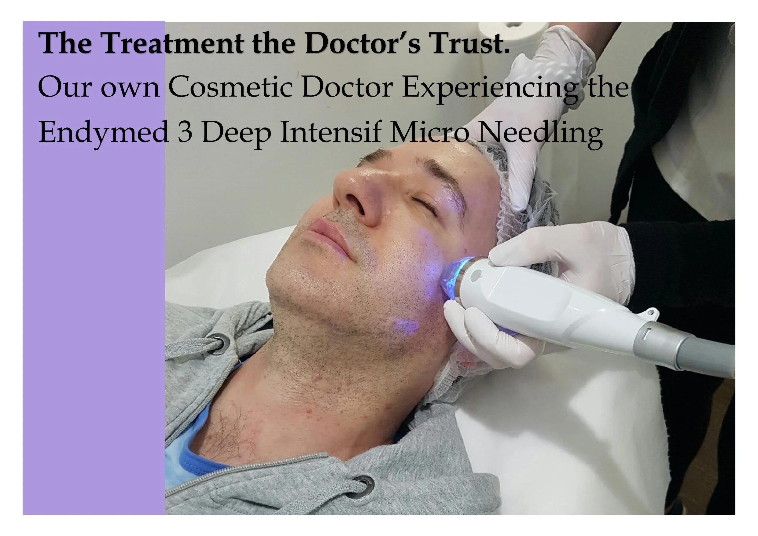EndyMed Skin Treatments — Hands-On Laser