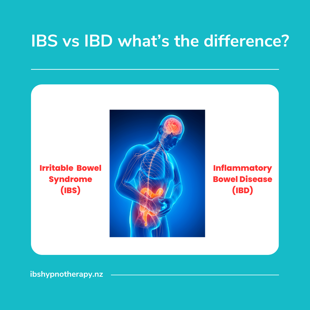 IBS vs IBD: Understanding the differences and how gut directed hypnotherapy can help — Irritable ...