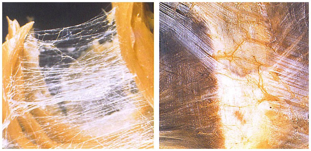 Fascia - The web without a weaver — Conscious Living Physical Therapy