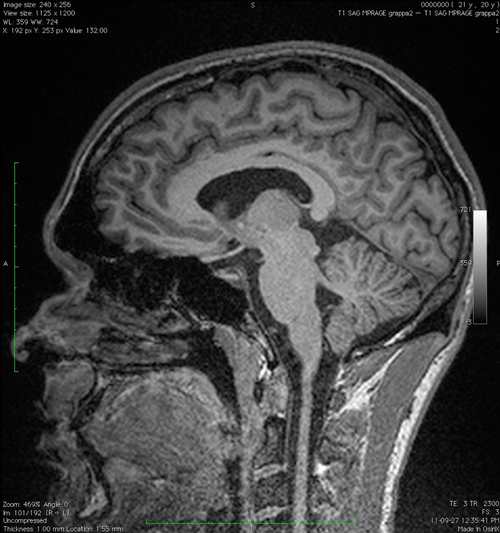 Build a Better Brain: How to Grow Grey and White Matter — Dr. Greg ...