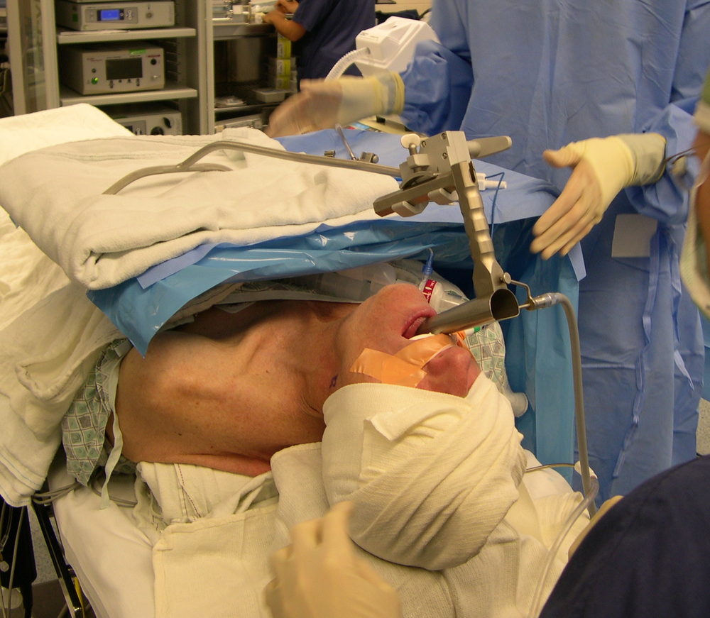 Treatments for Conditions of the Voice Box (Larynx)