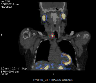 Parathyroid Gland | doctorlansford.com