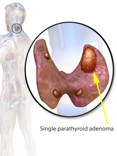 Parathyroid Gland | doctorlansford.com