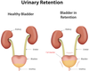 Urinary Retention After Surgery | doctorlansford.com