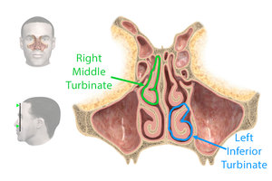 Turbinate Reduction | doctorlansford.com