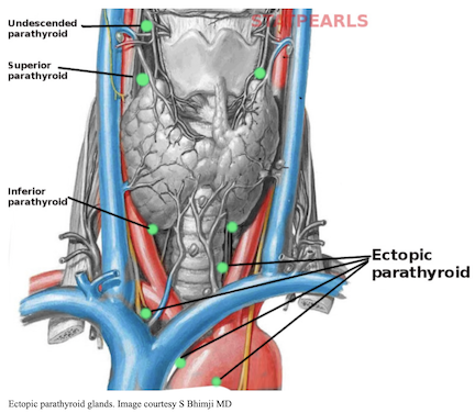 Parathyroid Gland | doctorlansford.com