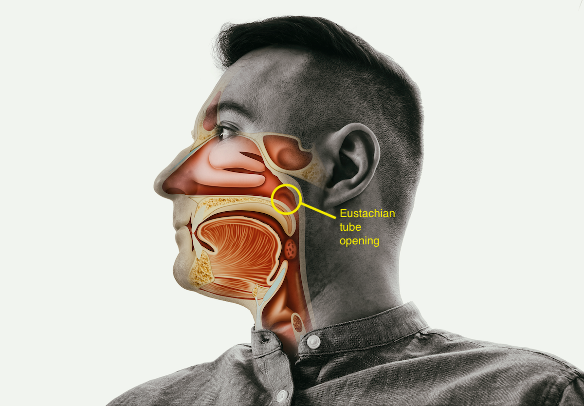 Conditions: Eustachian tube dysfunction | DoctorLansford.com