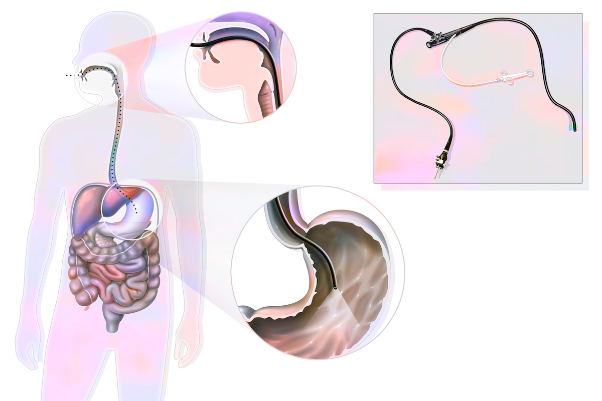 Swallowing Evaluations | doctorlansford.com