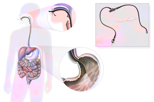 Swallowing Evaluations | doctorlansford.com