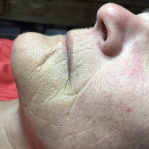 Facial Bar — Harlow Gold Salon and Spa