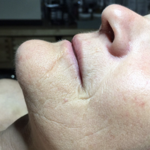 Facial Bar — Harlow Gold Salon and Spa