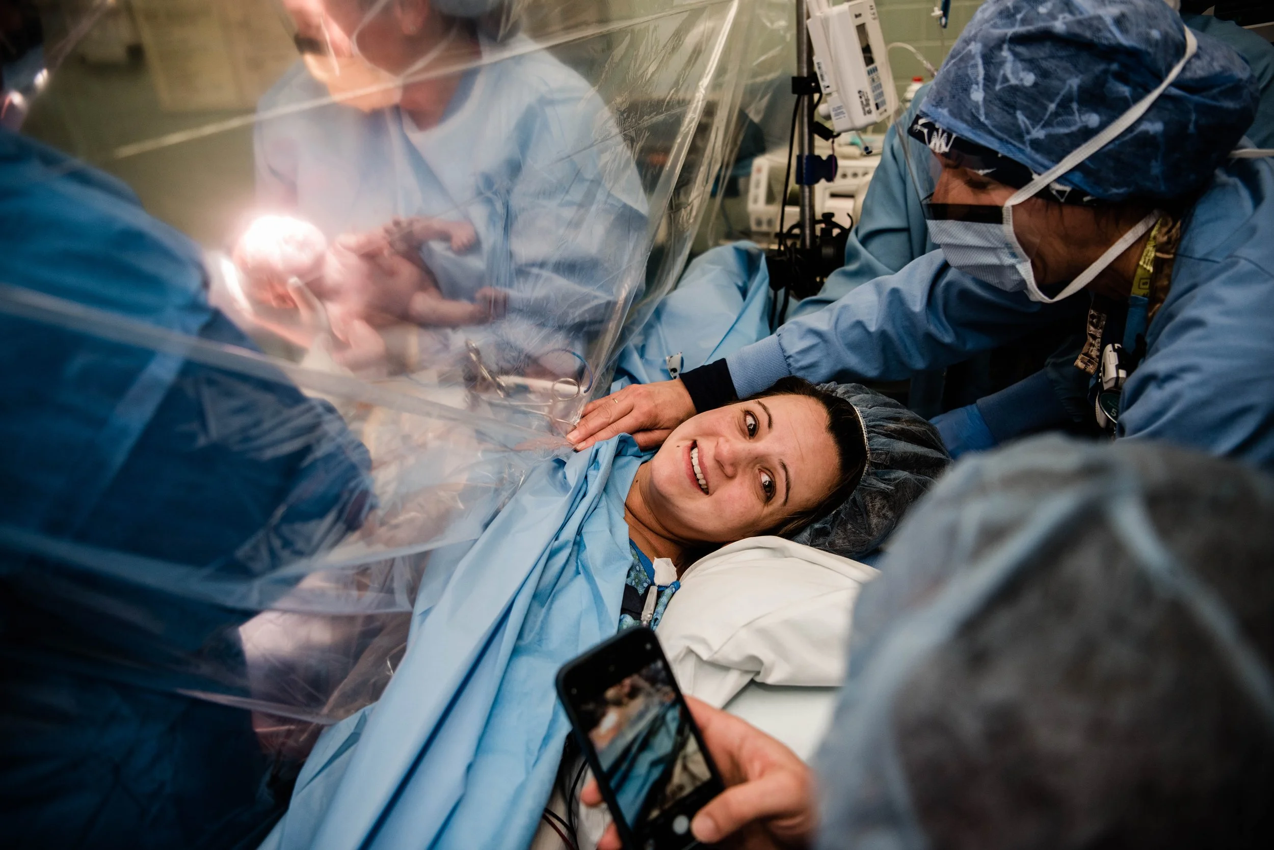 C Section Birth Photography