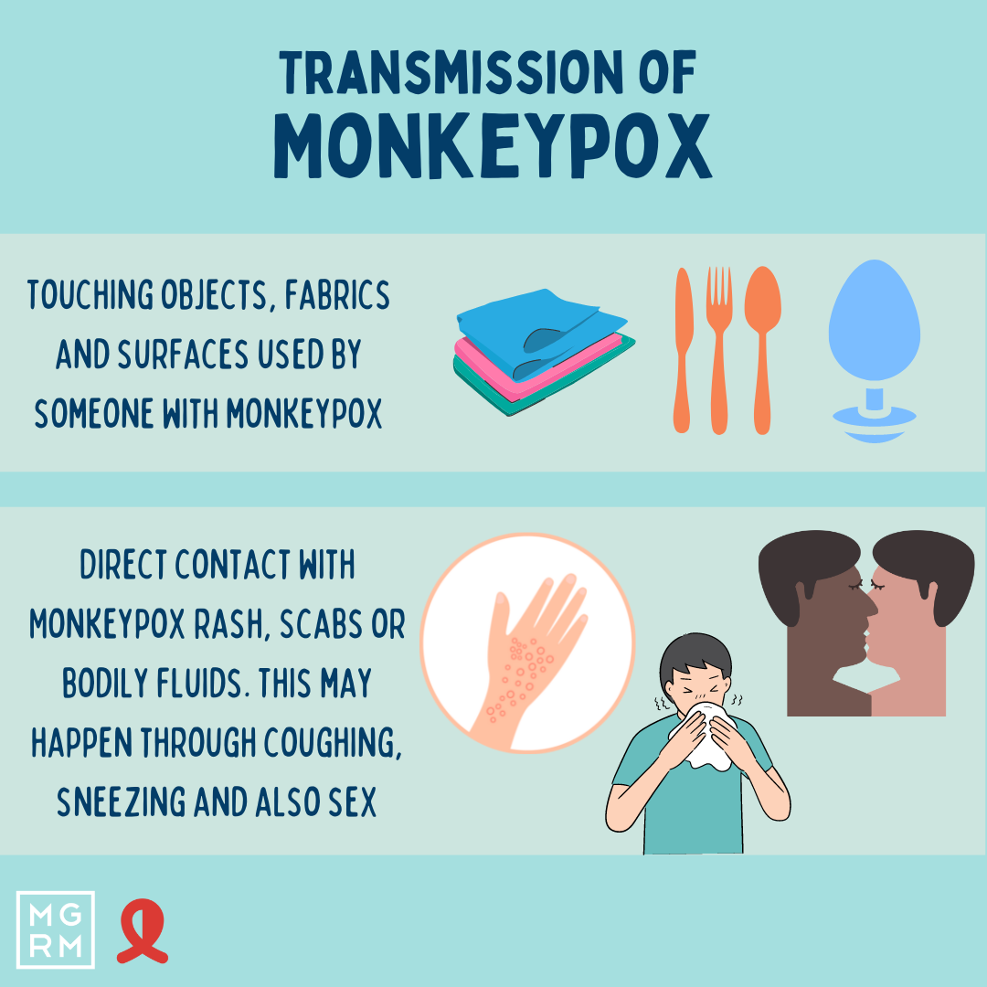 Monkeypox — HIV Malta