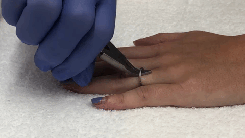 Ring Spreader Education — Mooney & Co., Inc.