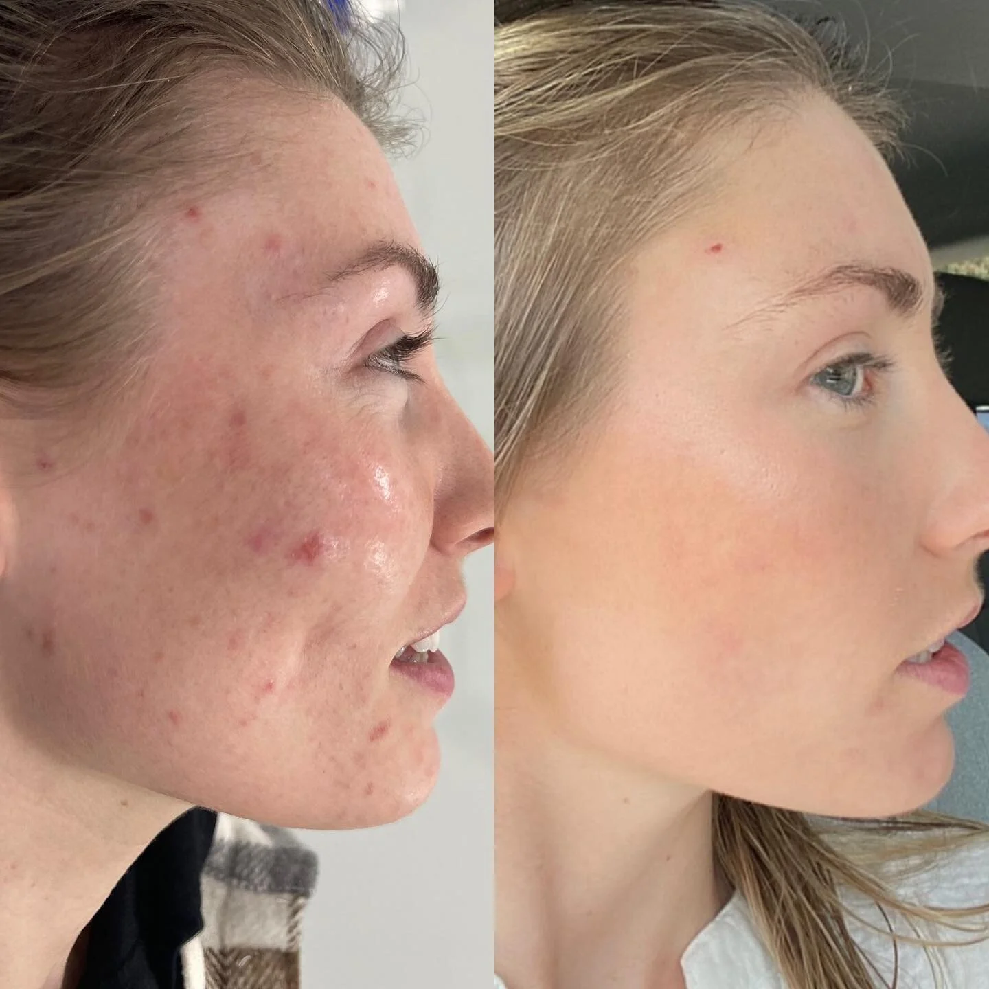 Diamond Glow Facial Menu — A Fine Line Aesthetics