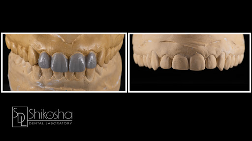 Crown & Bridge / Fixed — Shikosha Dental Lab