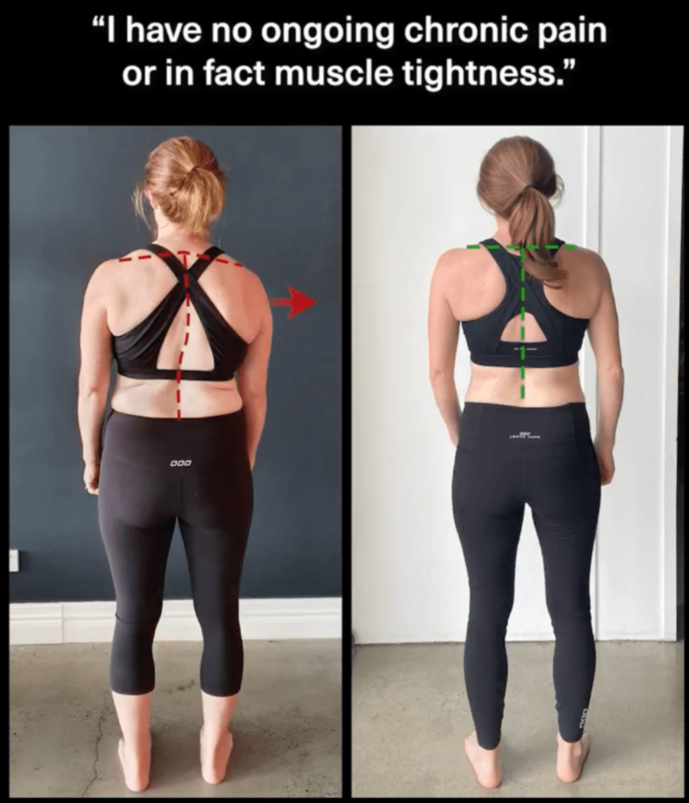 Functional Patterns Brisbane