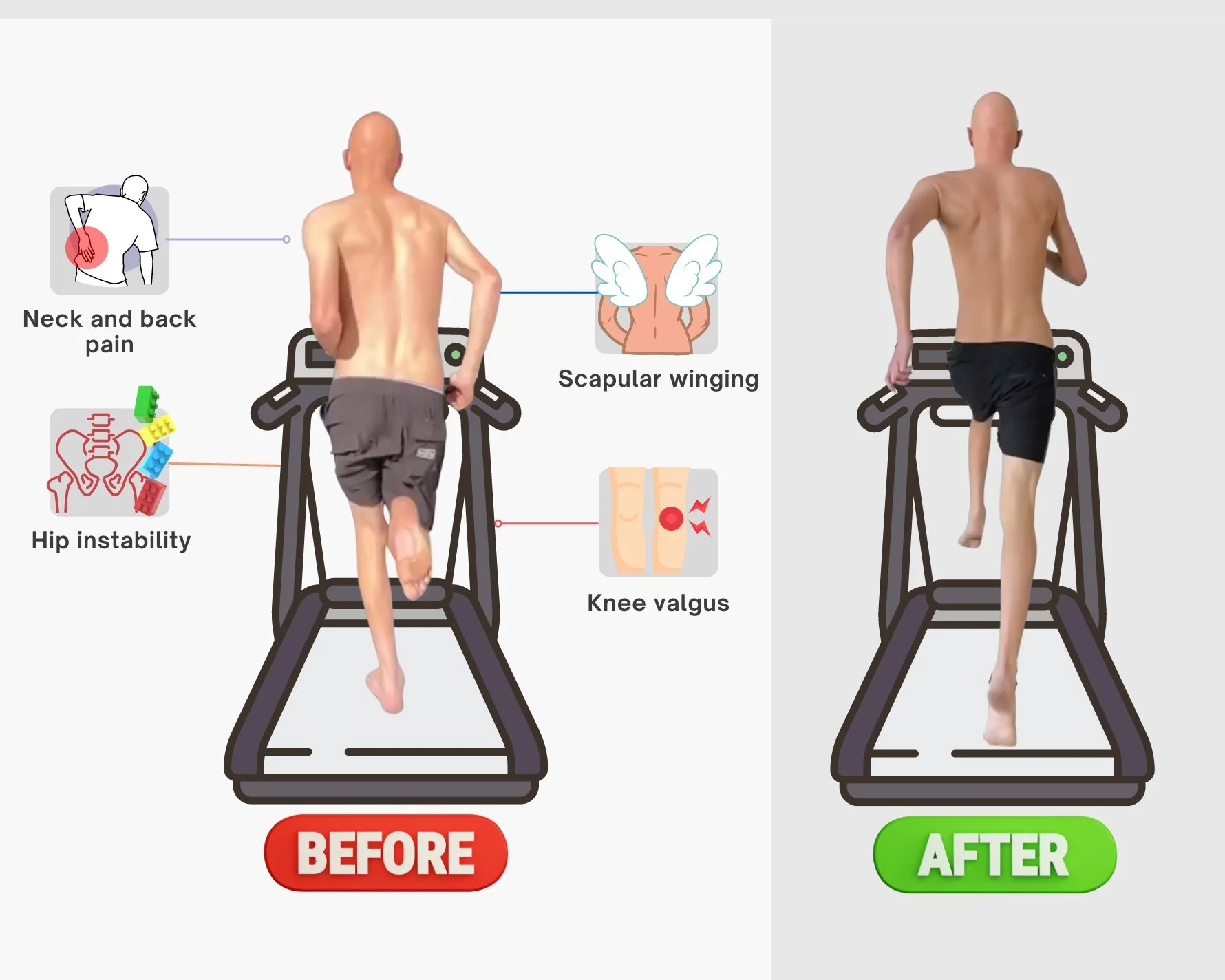 Incredible Scoliosis Results — Functional Patterns Brisbane