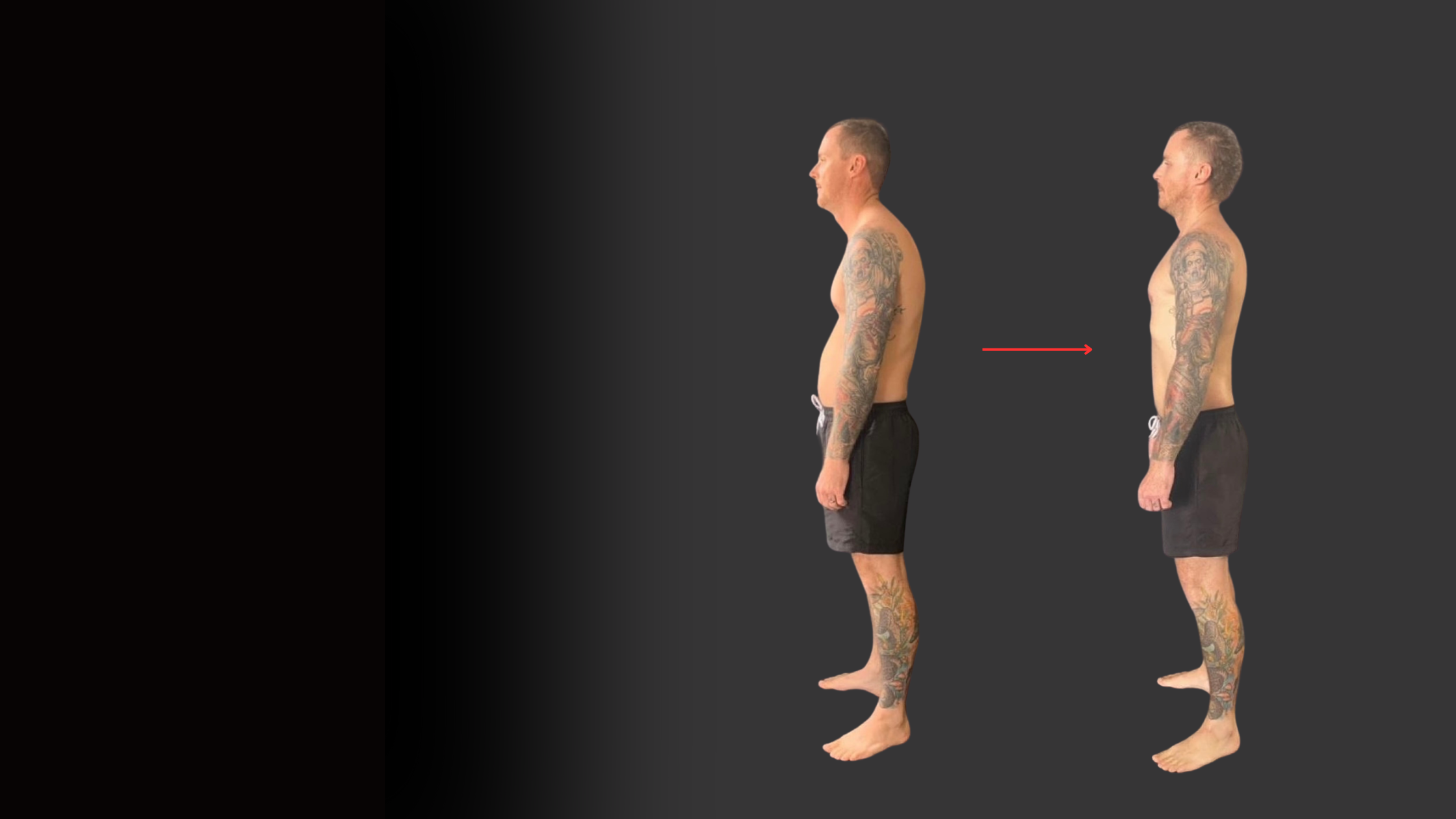 Posture Correction & Pain Relief | Functional Patterns Brisbane — Functional Patterns Brisbane