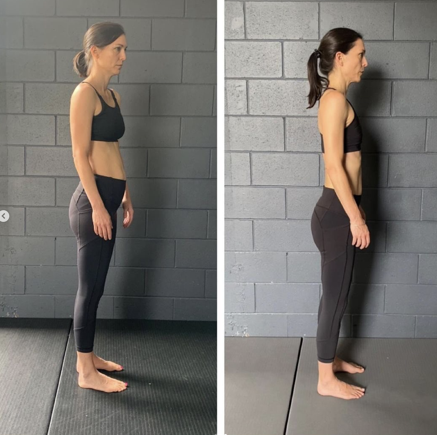 Understanding Poor Posture: A Comprehensive Guide — Functional Patterns ...