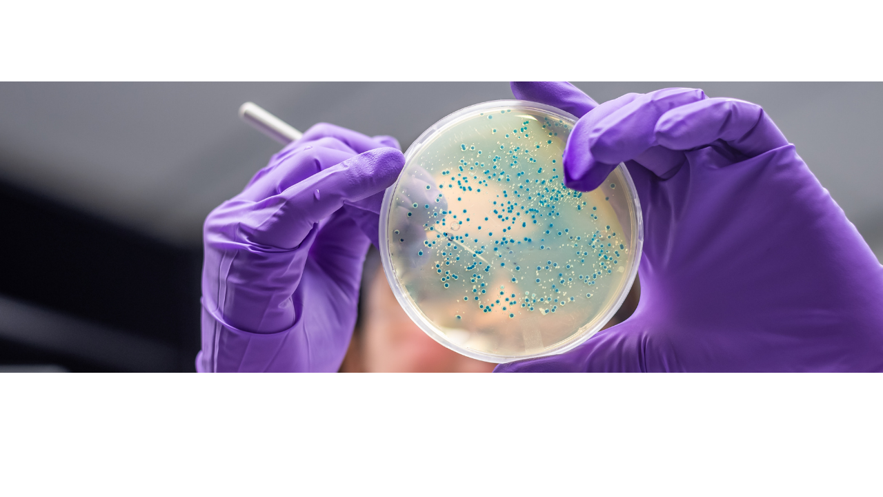 Microbiome Analysis — Australian BioCommons