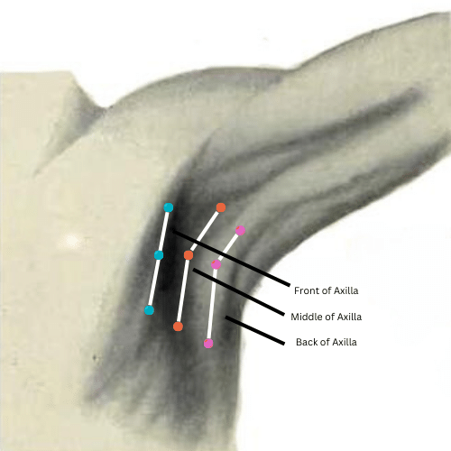 Self Lymph Node Screening — Starlight Health
