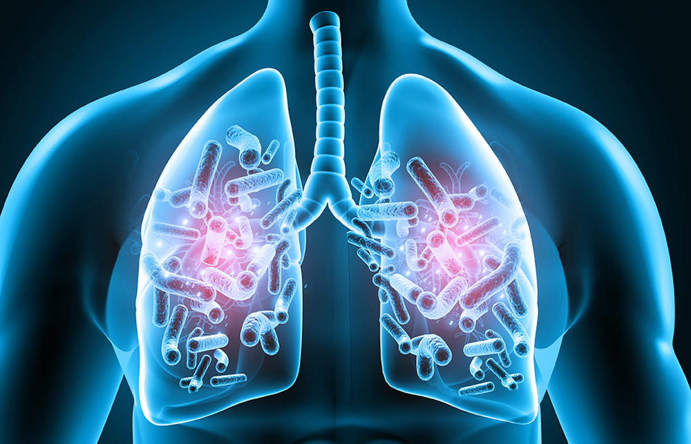 Weil Institute deputy director talks lung microbiome in Nature article ...