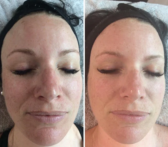 Skingoals & Reviews — Skin Depot Hamilton