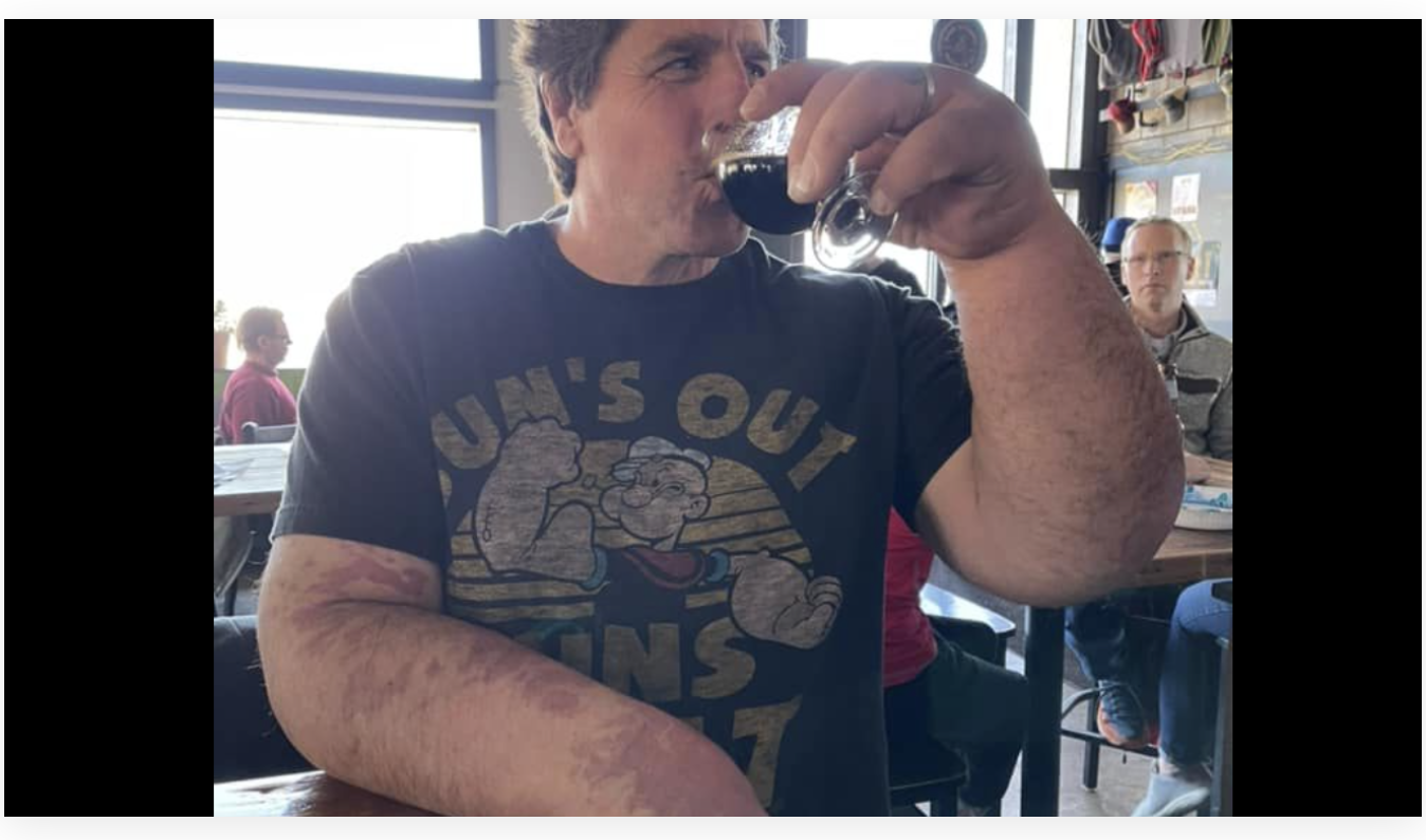 This MN man has very large arms and 1.1 million TikTok followers ...