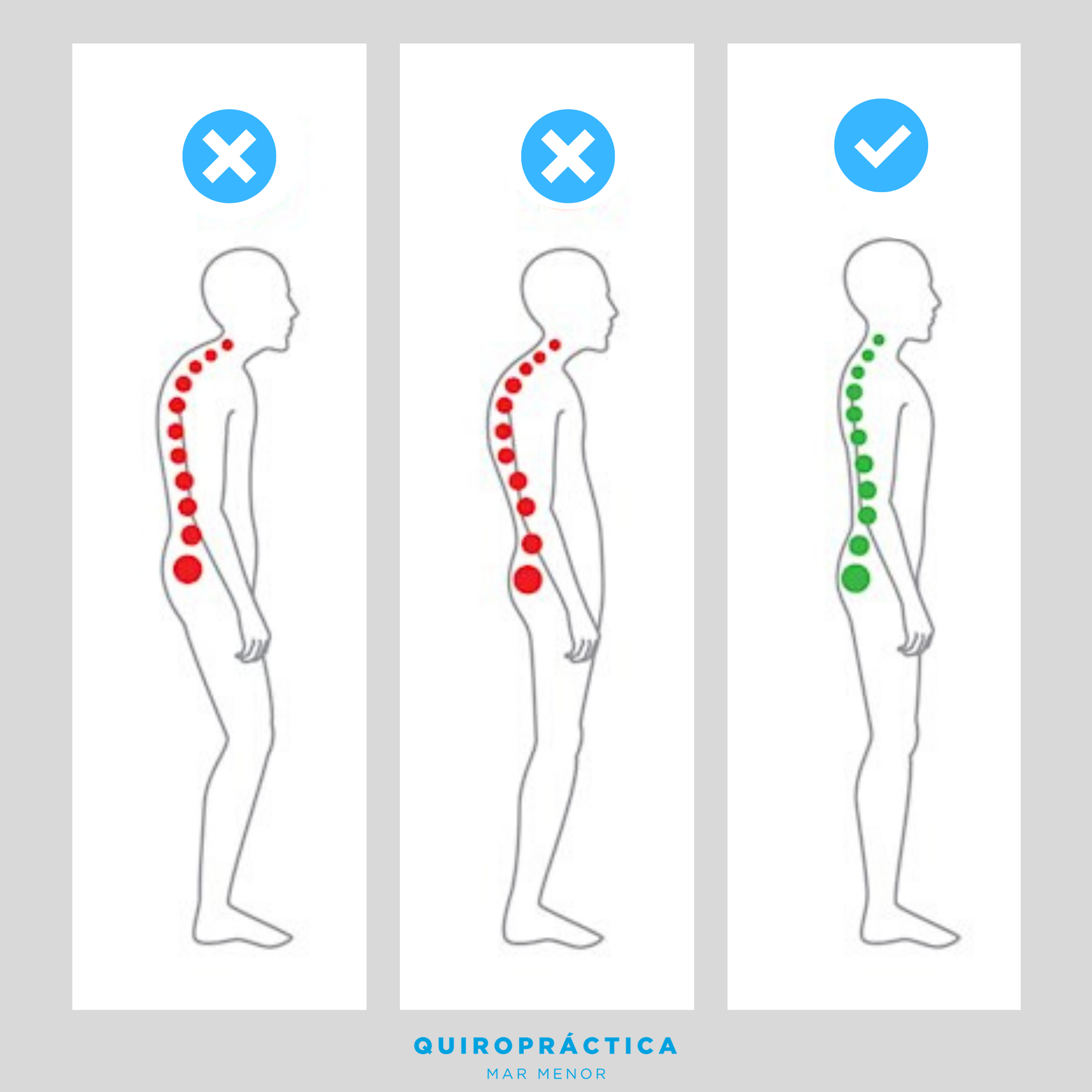 ¿Qué es la postura? — Quiropráctica Mar Menor