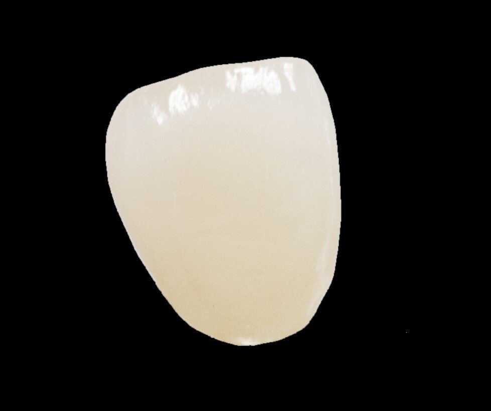 Crowns & Bridges — Hopetown Dental Lab