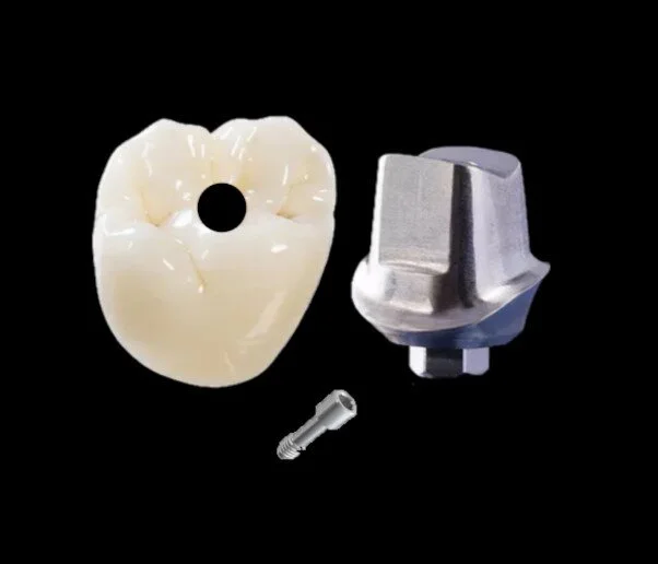 Choosing an Abutment Package — Hopetown Dental Lab