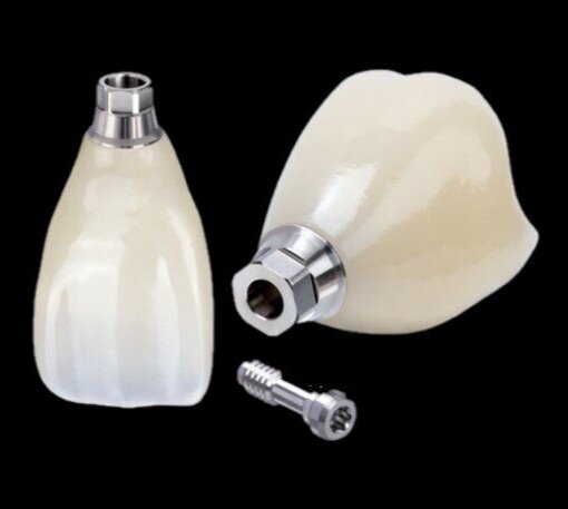 Choosing an Abutment Package — Hopetown Dental Lab