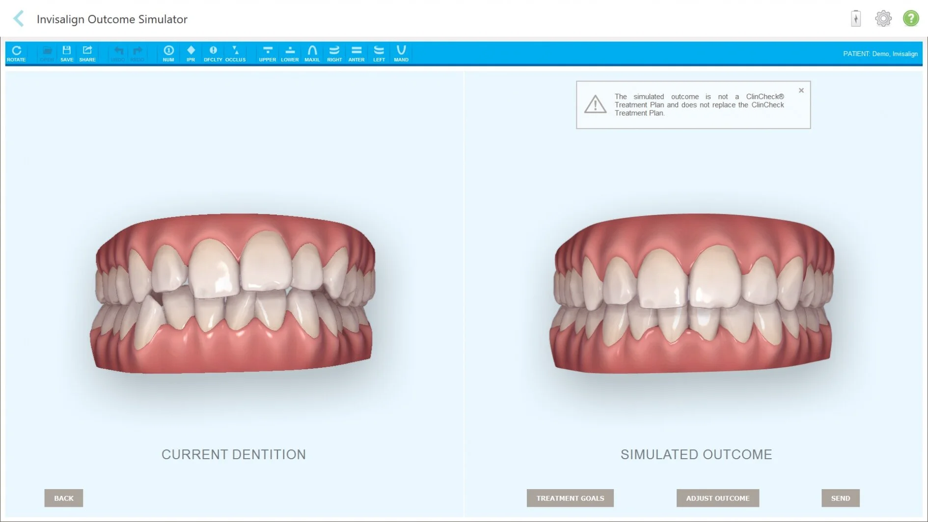 iTero — Invisalign Studio