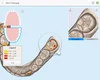 iTero — Invisalign Studio