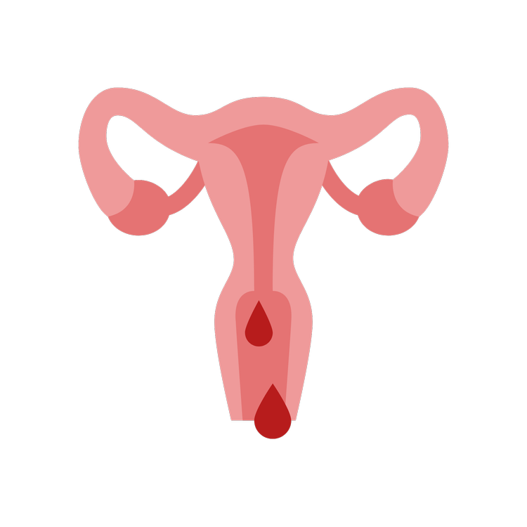 What is PCOS? Symptoms & Support Information QENDO