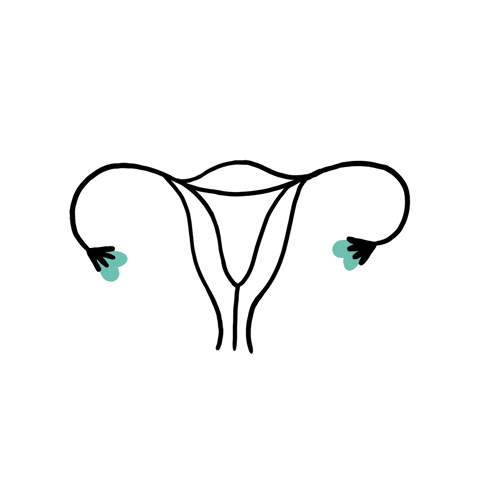 Understanding PCOS: Causes and Treatments — Trista Chan RD, MHSc