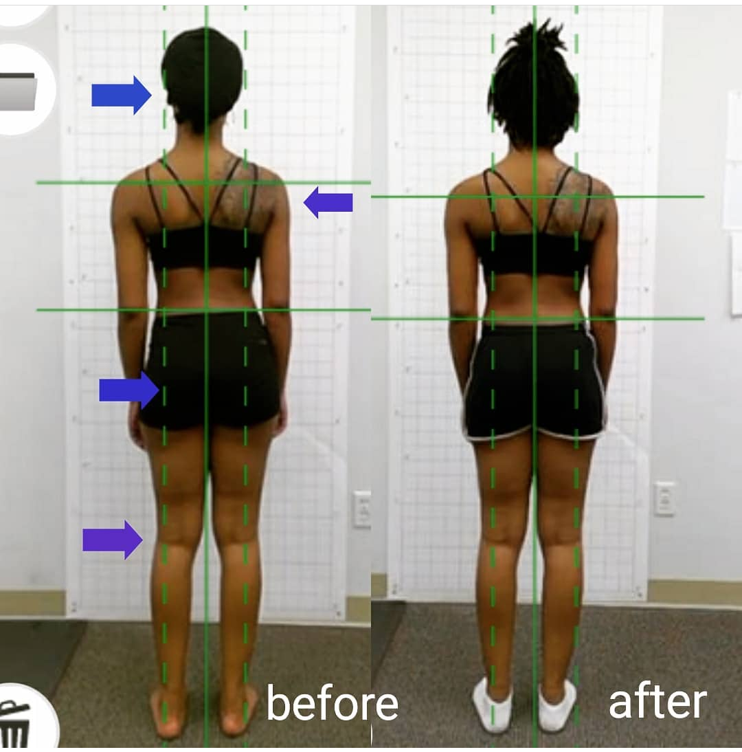 Posture Alignment Therapy Edgewater, PTX — Posture Therapy Edgewater ...