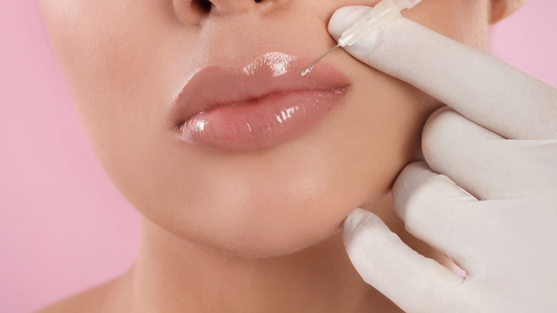 The Alarming New Trend of DIY Lip Fillers — PBL Magazine