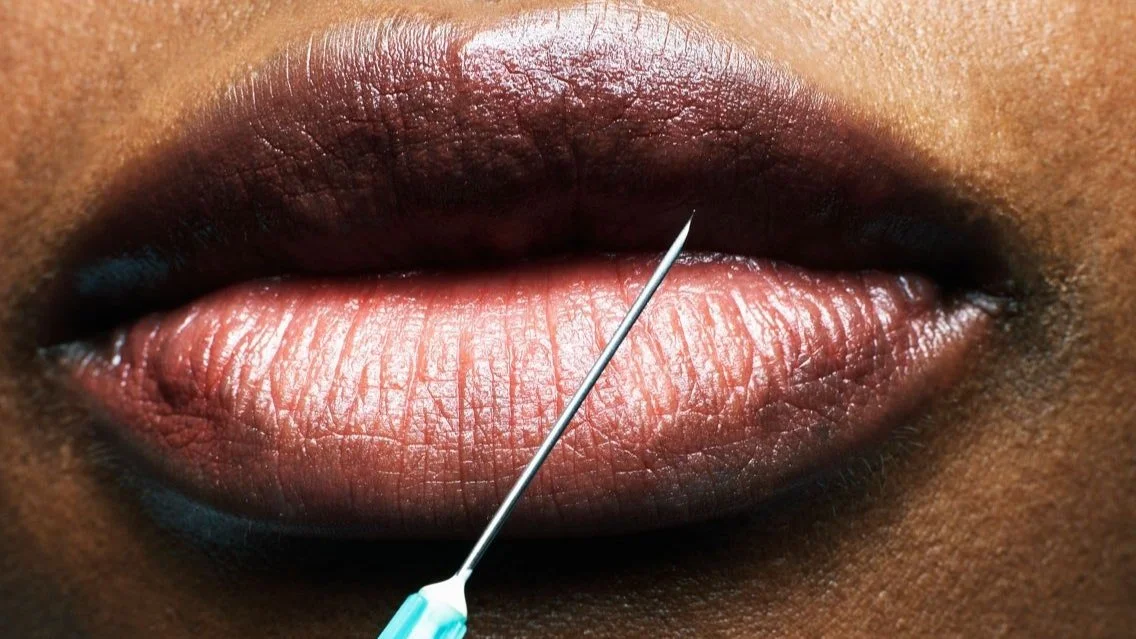 The Secrets of how to Potentially Avoid Dermal Filler Complications ...