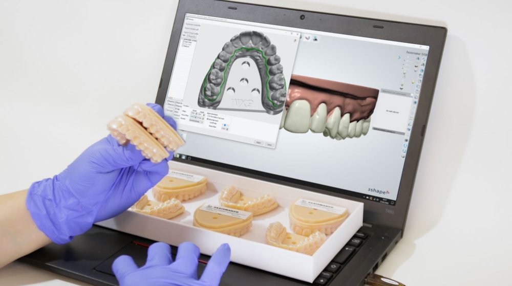 5Xtrim Aligner Trimming — 5AXISMAKER