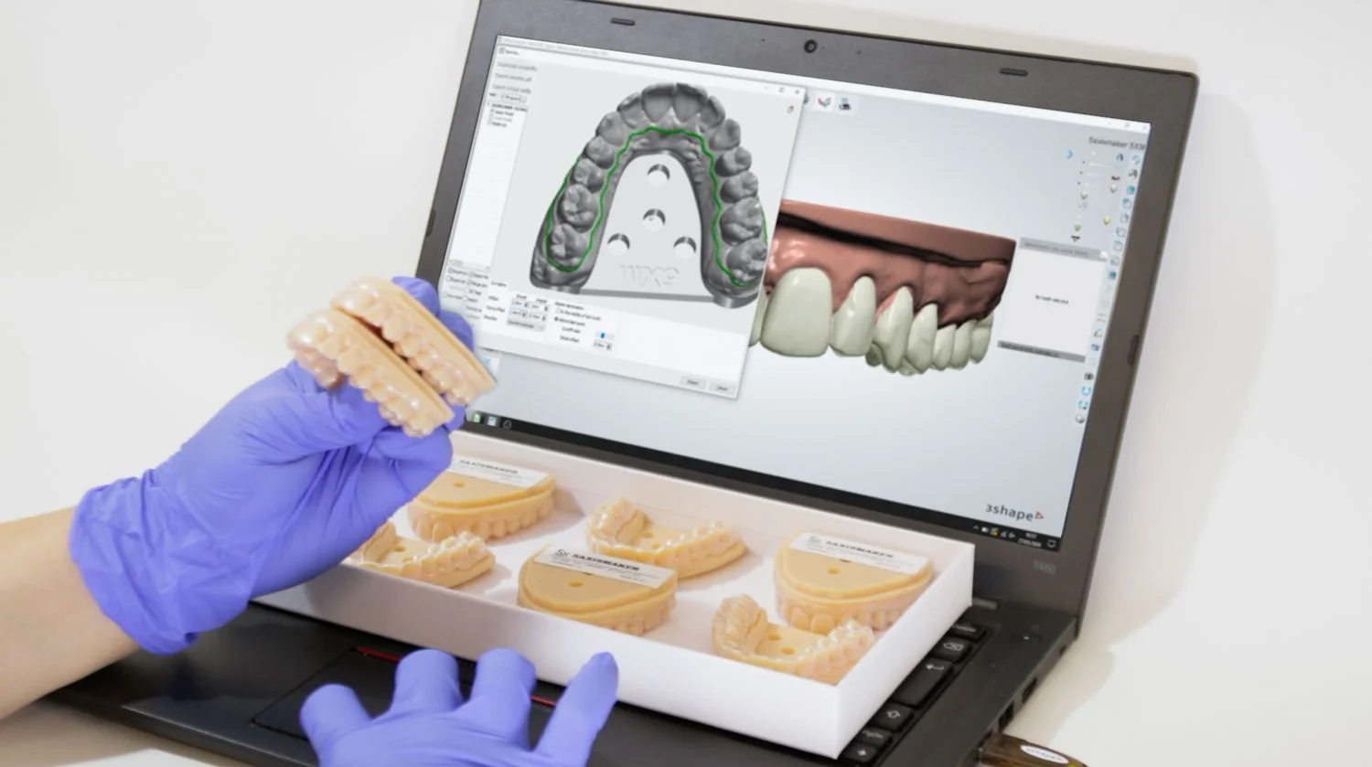 5Xtrim Aligner Trimming — 5AXISMAKER