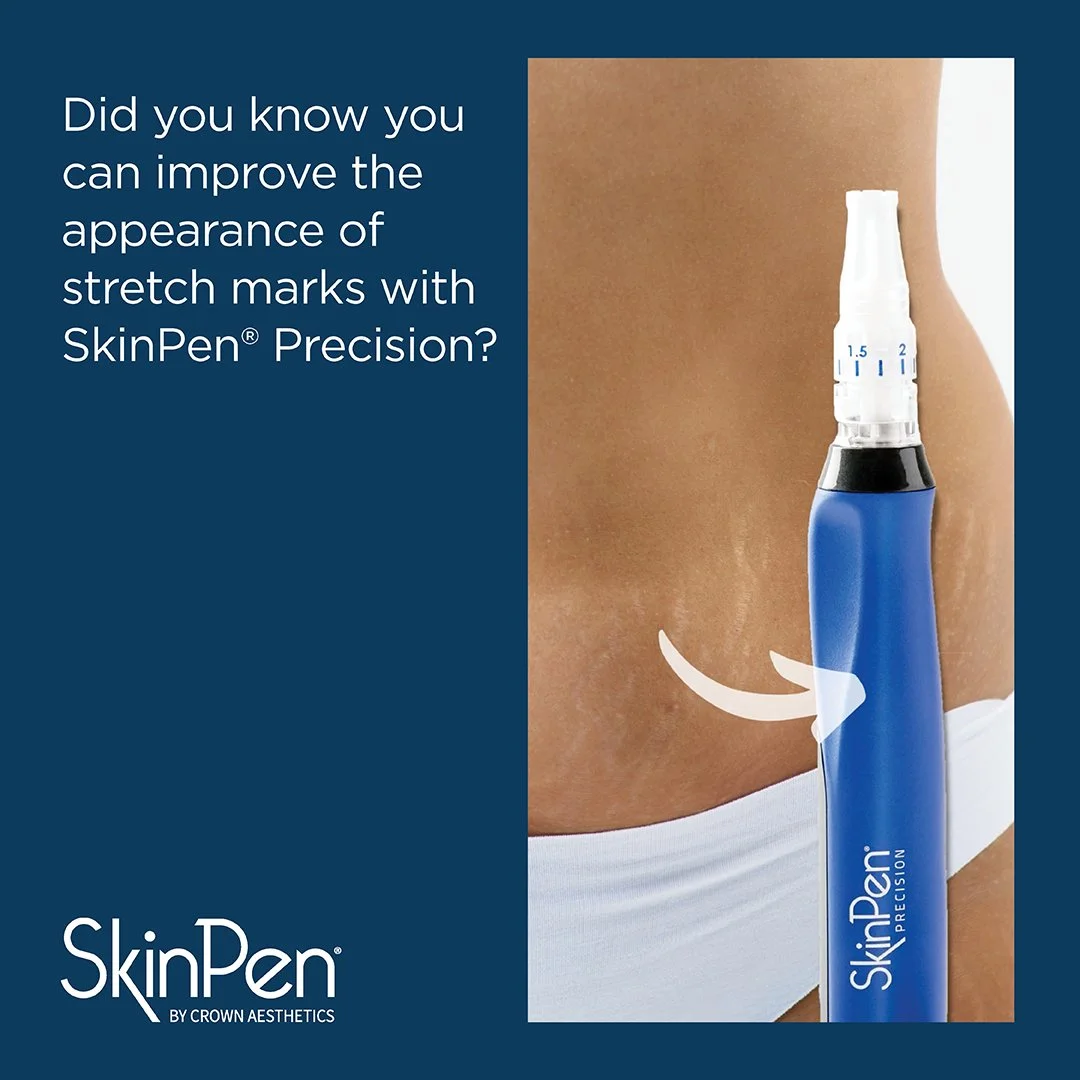 Micro Needling — The Dermal Health Alliance