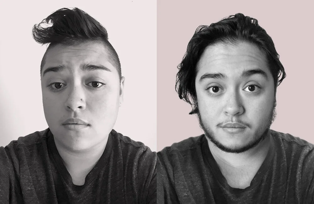 Ftm Before And After Face