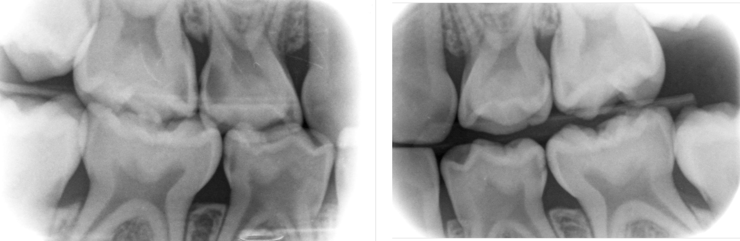 Part 1: Evidence for Radiographic Examinations in Paediatric Dentistry ...
