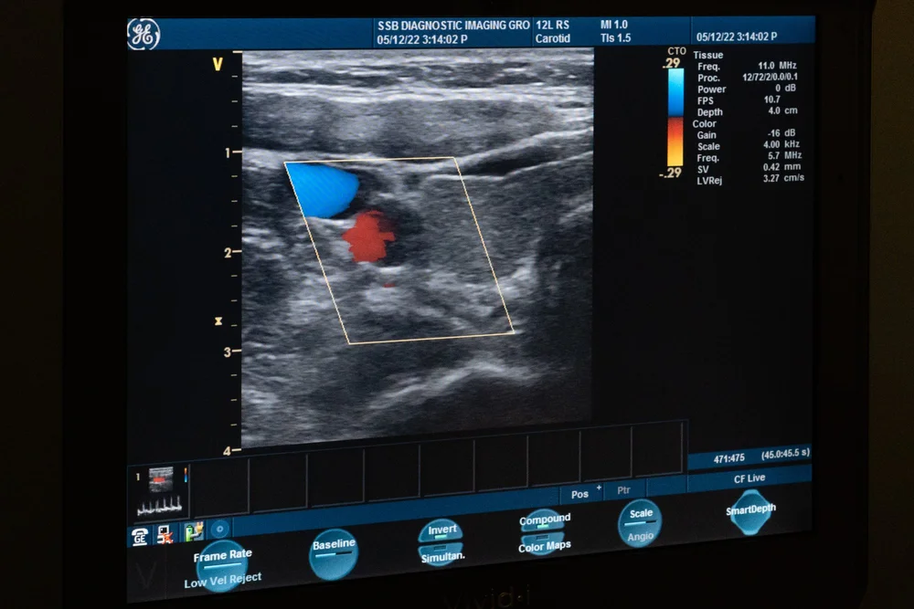 Ultrasound Services In Honolulu, HI 96815 — Doctors of Waikiki HI ...