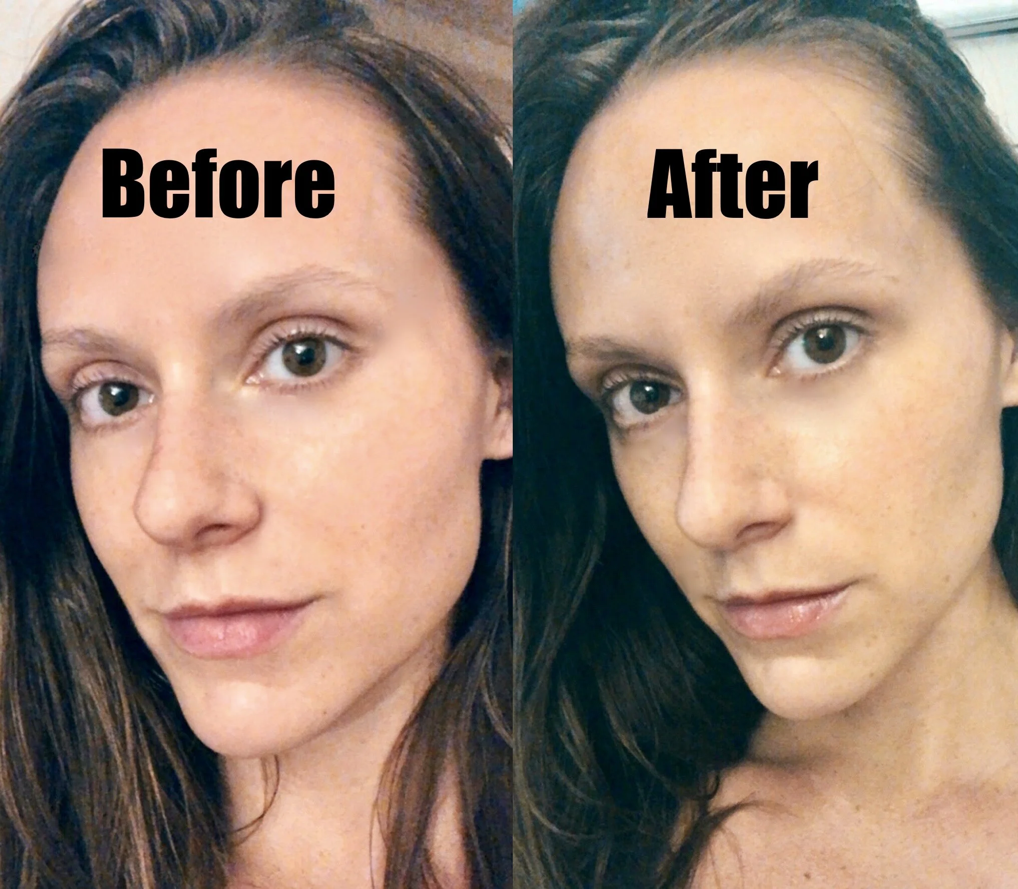 Unibrow Before And After