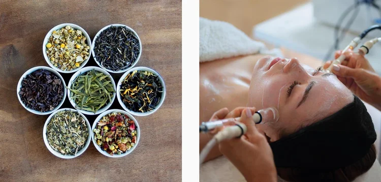 Arogya Holistic Healing: Acupuncture & Chinese Medicine in Westport, CT
