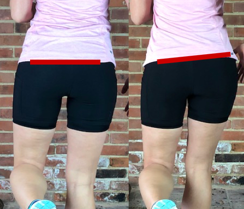Running Biomechanics: Gluteal Compensation Patterns — Precision ...