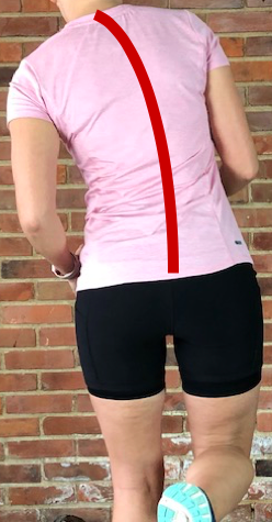 Running Biomechanics: Gluteal Compensation Patterns — Precision ...